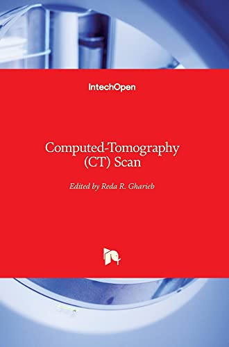 Buy Computed-Tomography (CT) Scan Book Online at Low Prices in India ...