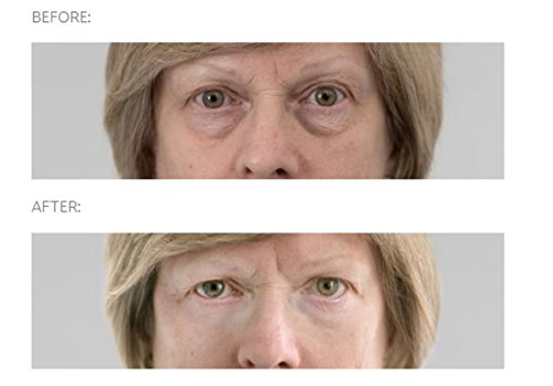 Beverly Hills Instant Facelift & Eye Tuck 30ml : Beauty Products ...