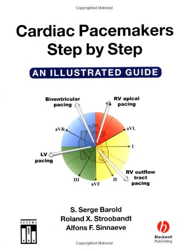 Cardiac Pacemakers Step by Step: An Illustrated Guide : Barold, S ...