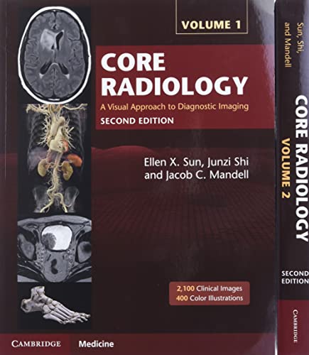 Buy Core Radiology: A Visual Approach to Diagnostic Imaging Book Online ...