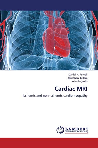 Buy Cardiac MRI Book Online at Low Prices in India | Cardiac MRI ...