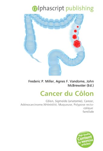 Amazon.fr - Cancer du Côlon: Côlon, Sigmoïde (anatomie), Cancer ...