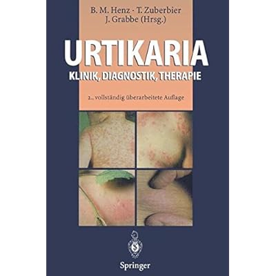Bücher Online Herunterladen Kostenlos 133: [PDF] Urtikaria: Klinik - Diagnostik - Therapie ...