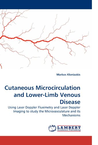 Cutaneous Microcirculation And Lower Limb Venous Disease Using Laser