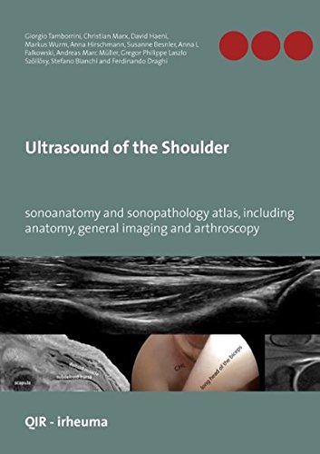 Buy Ultrasound of the Shoulder: sonoanatomy and sonopathology atlas of ...