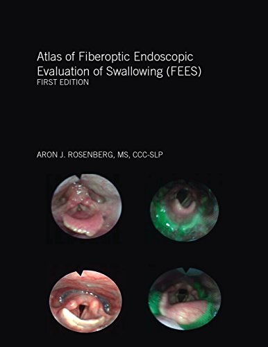 Amazon.fr - Atlas of Fiberoptic Endoscopic Evaluation of Swallowing ...