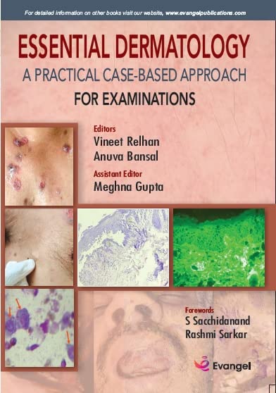 Buy ESSENTIAL DERMATOLOGY A PRACTICAL CASE-BASED APPROACH FOR ...