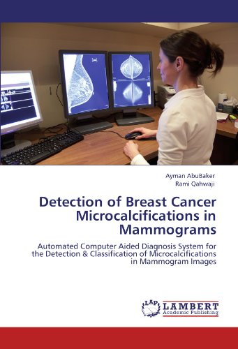 Detection Of Breast Cancer Microcalcifications In Mammograms Automated Computer Aided ...