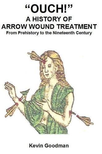 Ouch! A History of Arrow Wound Treatment from Prehistory to the ...