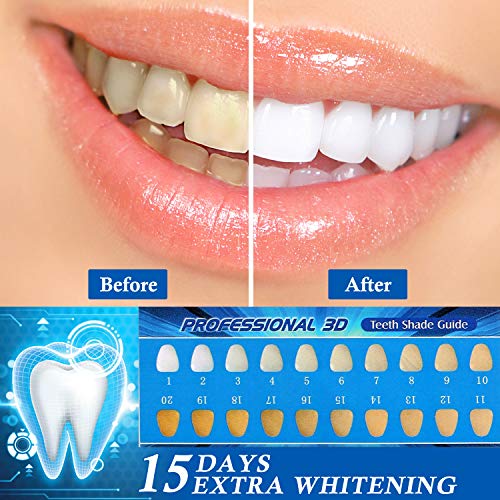 Siman - Teeth Whitening Kit Zahnaufhellung Set für Weisse Zähne ...