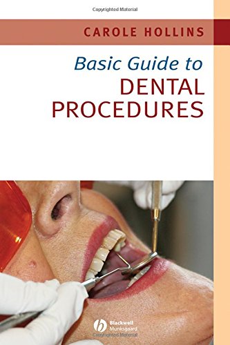 Basic Guide to Dental Procedures (Basic Guide Dentistry Series): Amazon ...