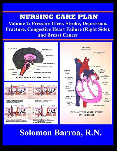 Buy Nursing Care Plan: Volume 2 (Pressure Ulcer, Stroke, Depression ...