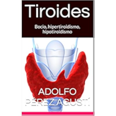 Roman Anton: Tiroides: Bocio, Hipertiroidismo, Hipotiroidismo ...