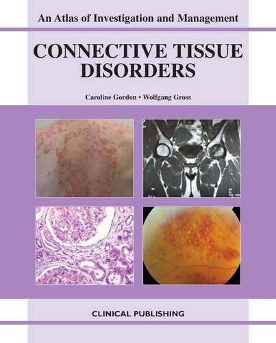 Buy Connective Tissue Diseases (Atlas of Investigation and Management ...