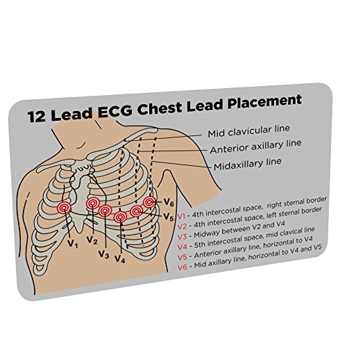 12 Lead ECG Chest Lead Placement (Paramedic, Nurse, EKG) pocket ...