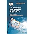 TNM Classification of Malignant Tumours, 8th Edition : Brierley: Amazon ...