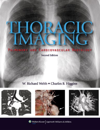 Thoracic Imaging: Pulmonary and Cardiovascular Radiology : Webb M.D., W ...