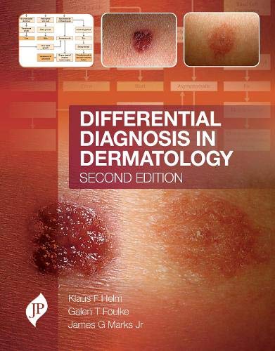 Amazon.in: Buy Differential Diagnosis in Dermatology: Second Edition Book Online at Low Prices ...