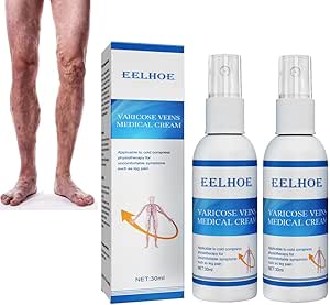Veinhealing Varicose Veins Treatment Spray varicose Veins Treatment ...