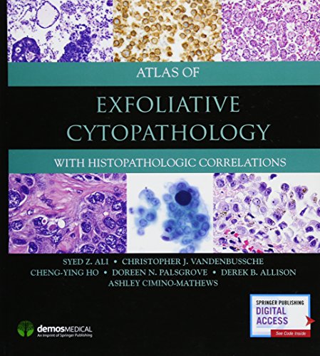 Buy Atlas of Exfoliative Cytopathology: With Histopathologic ...
