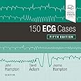 150 ECG Cases, 5e, Paperback: Amazon.co.uk: Hampton DM MA DPhil FRCP ...