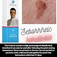 The Seborrheic keratosis Removal Glycolic Acid Peel Solution, The ...