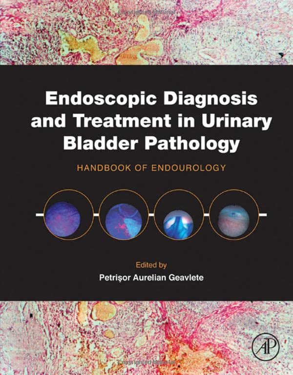 Buy Endoscopic Diagnosis and Treatment in Urinary Bladder Pathology ...