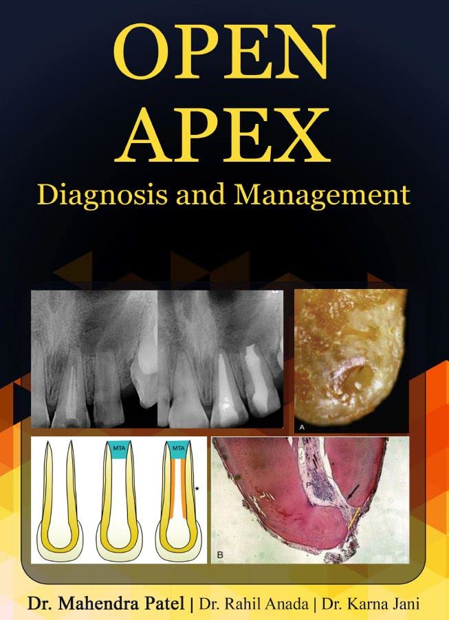 Buy OPEN APEX Diagnosis and Management Book Online at Low Prices in ...