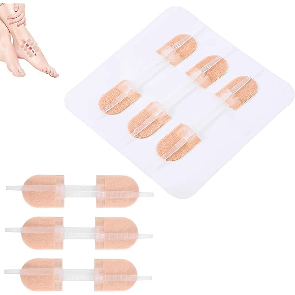 Outdoor Medical Supplies 6-Pack Emergency Wound Closure Strips - Quick ...