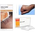 CICA-CARE Silicone Gel Sheet - 1 Dressing (12cm X 6cm) : Amazon.in ...