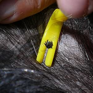 Pets Empire 2pcs Deer Tick Remover Small & Large Set - Easy 2-in-1 ...