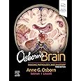 Osborn's Brain : Buy Online at Best Price in KSA - Souq is now Amazon ...