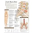 Understanding Low Back Pain Anatomical Chart : Anatomical Chart Company ...