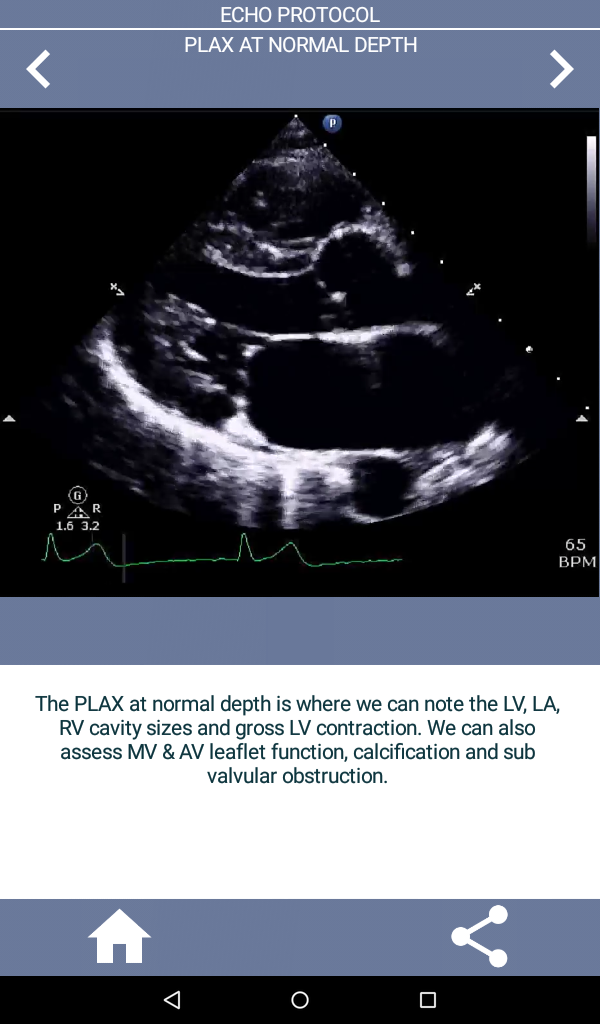 LEARN THE FULL TTE ECHO ULTRASOUND PROTOCOL DEMO: Amazon.co.uk ...
