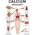 Anne Print Solutions ® Calcium Deficiency Paper Poster for Hospital ...