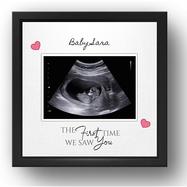 Frame Baby Ultrasound