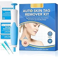 Skin Tag Removal - Auto Skin Tag Remover Pen Kit with 60 Micro and ...