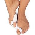 Valgomed Bunion Toe Stretcher Expander : Amazon.com.be: Health ...