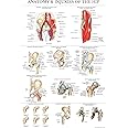 Laminated Anatomy and Injuries of The Hip Poster - Hip Joint Anatomical ...