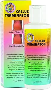 Mr. Pumice Callus Terminator : Amazon.co.uk: Health & Personal Care