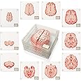 Anatomic Brain Specimen Coasters (Set of 10) - Neuroscience Gifts Best ...