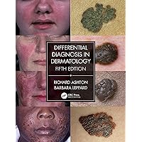 Differential Diagnosis in Dermatology by Ashton, Richard