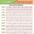 12 Lead EKG Pocket Card : Desconocido: Amazon.es: Libros