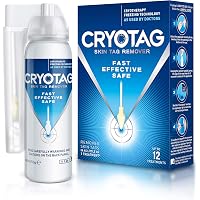 Auto Skin Tag Remover Kit for Face & Body, Upgraded Fast and Easy ...