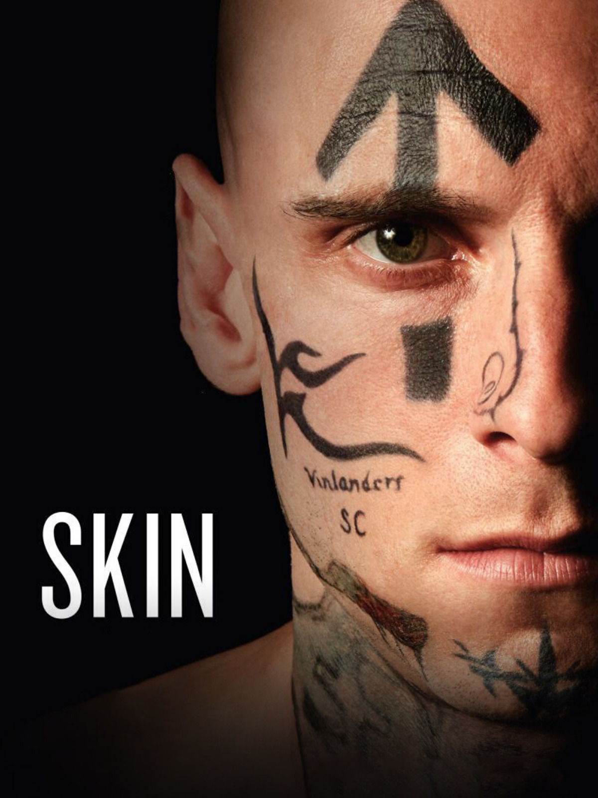 Prime Video: Skin